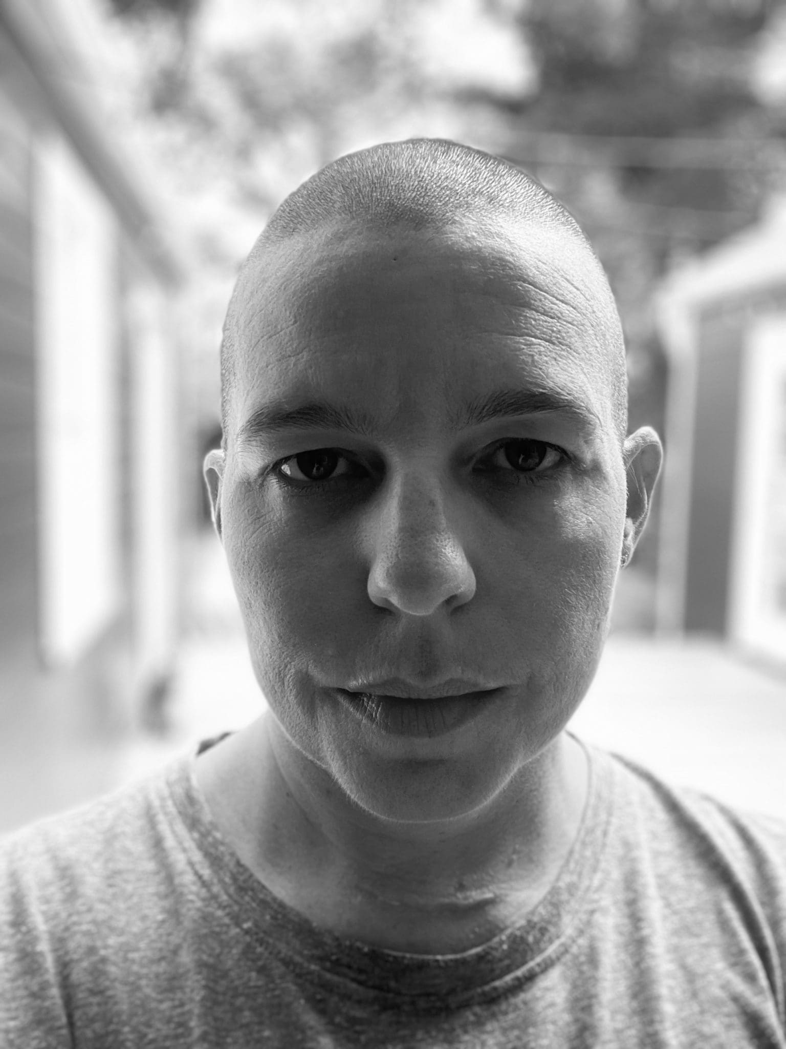 Rediscovering Myself after Thyroid Surgery - AMR